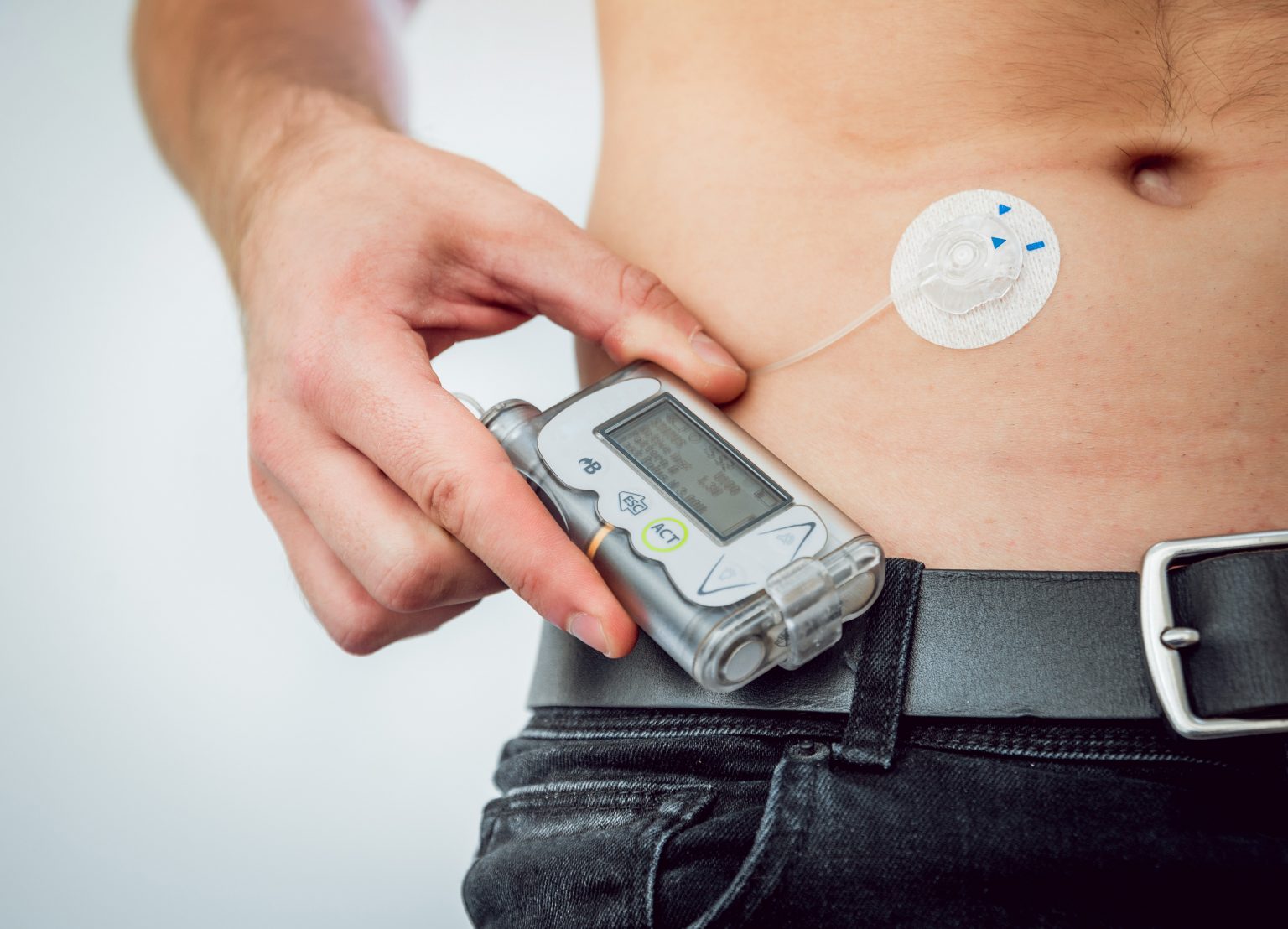 How Do Insulin Pumps Work? Types, Functions, and Components